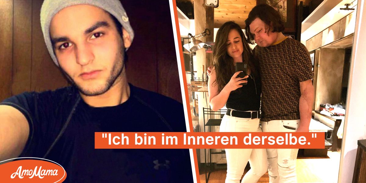 21-Jähriger erhält nach Gesichtstransplantation das Gesicht eines 48 ...